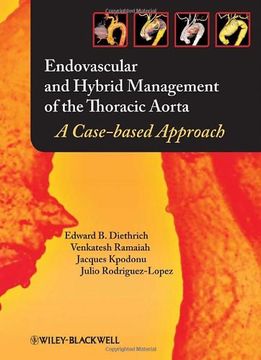 Libro Endovascular and Hybrid Management of the Thoracic Aorta: A Case ...