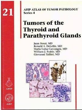 Libro Tumors of the Thyroid Glands (Atlas of Tumor Pathology) (en Inglés) De American Registry ...