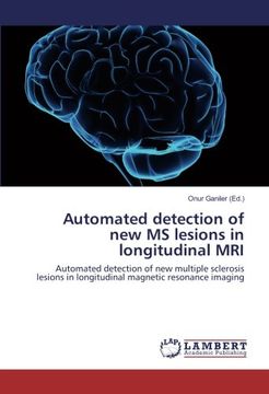 Libro Automated detection of new MS lesions in longitudinal MRI: Automated detection of new ...