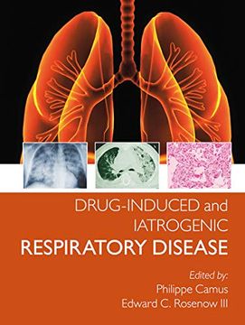 Libro Drug-Induced and Iatrogenic Respiratory Disease (en Inglés) De ...