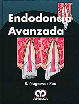 Libro Endodoncia Avanzada De R. Nageswar Rao - Buscalibre