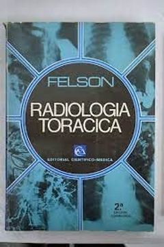 Libro Radiologia Toracica De Felson,B. - Buscalibre