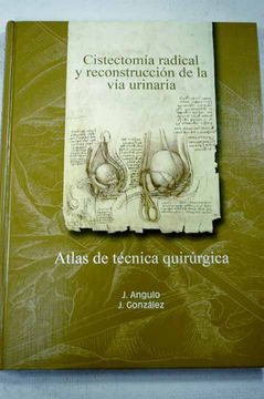 Libro cistectomía radical y reconstrucción de la vía urinaria : atlas ...